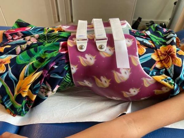 Braces - Dutch Scoliosis Center